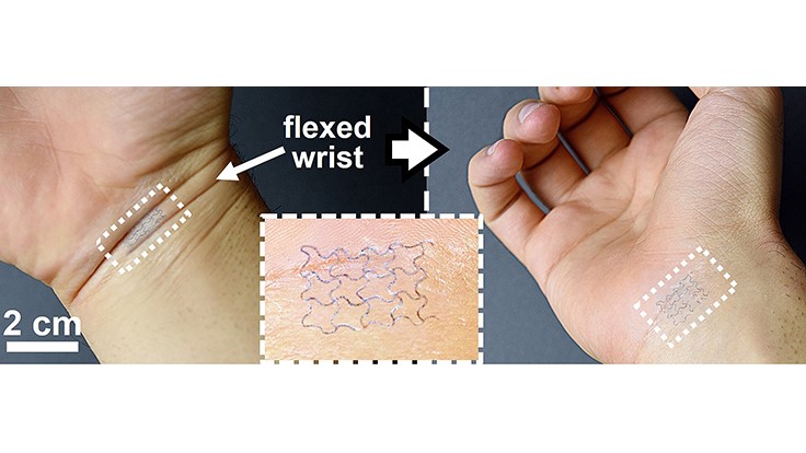 Biocompatible, breathable smart stickers - Today's Medical Developments