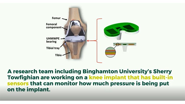 Smart, self-powered knee implants (Video) - Today's Medical Developments