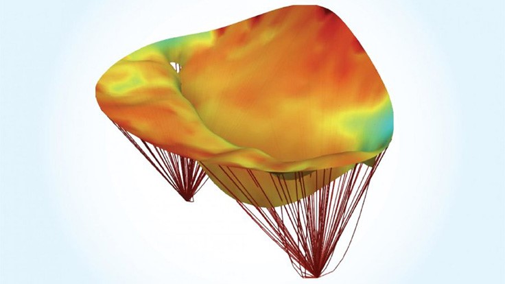 Heart valve modeling technique; customized medical care - Today's ...