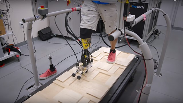 Tool for designing prosthetic limbs (Video) - Today's Medical Developments