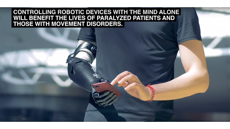Non-invasive mind-controlled robotic arm (Video) - Today's Medical ...