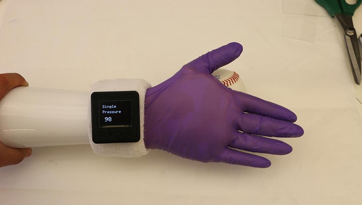 Sensor-instrumented glove for prosthetic hands - Today's Medical ...