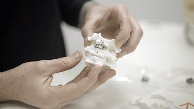 Additive manufacturing spinal implants (video) - Today's Medical ...