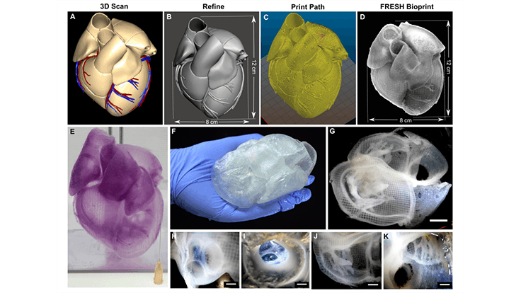 3D bioprinted heart; a new tool for surgeons - Today's Medical Developments