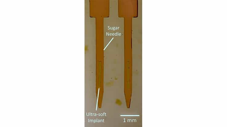Sweet, soft solution to hard brain implants - Today's Medical Developments