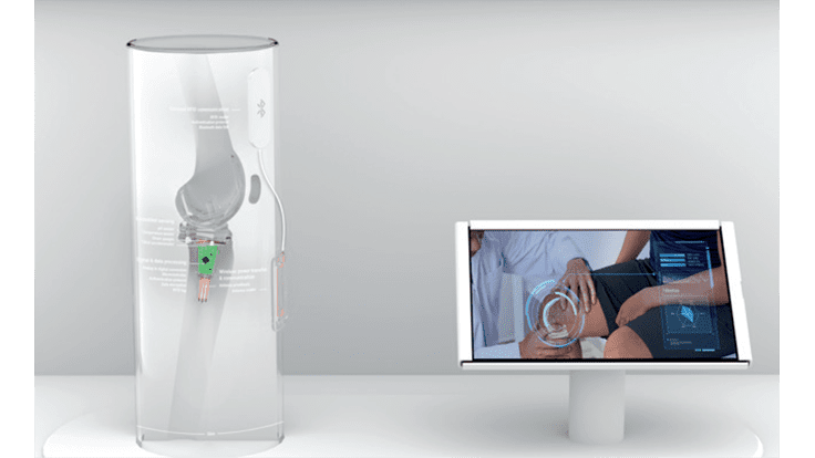 FollowKnee multi-sensor system for knee-implants - Today's Medical ...