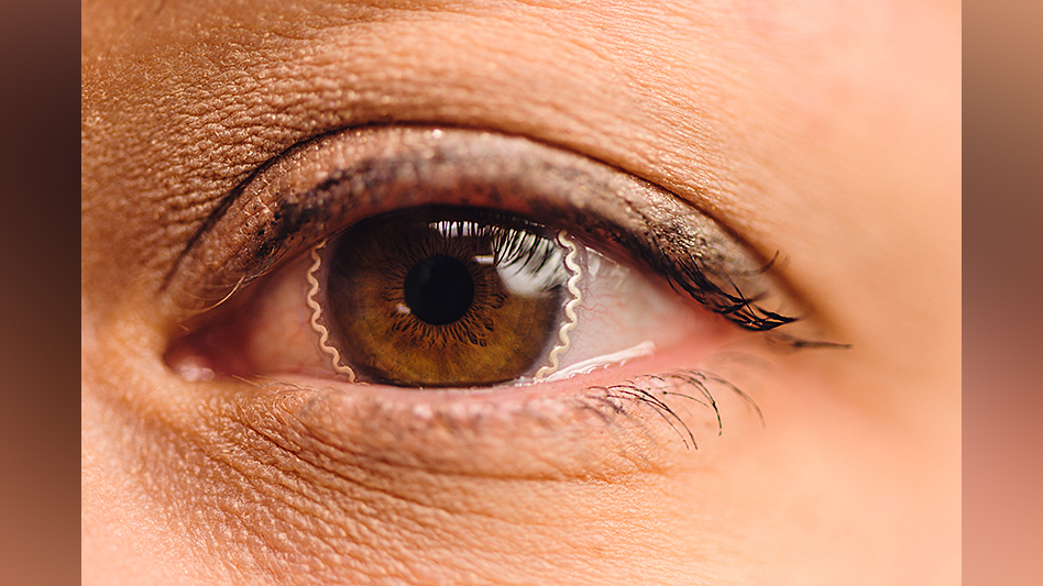 Startup developing smart contact lenses for glaucoma diagnosis ...