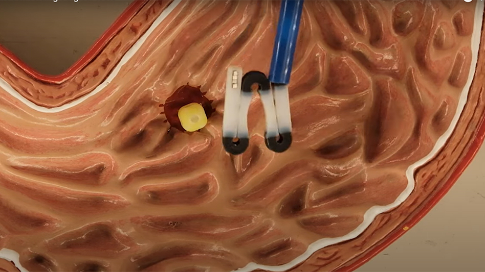 How to make self-folding surgical tools - Today's Medical Developments