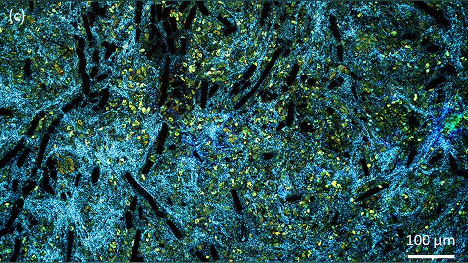 Full-field optical coherence technology - Today's Medical Developments