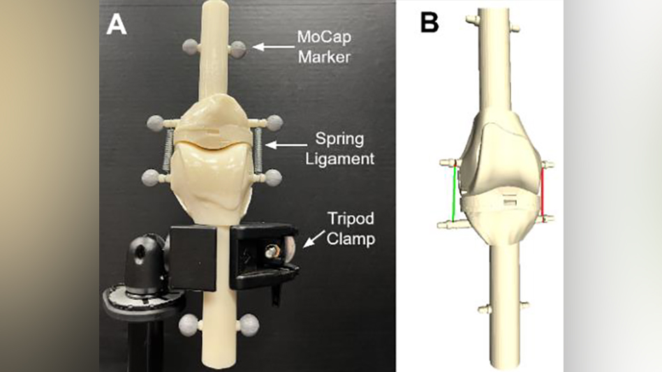 Improving knee implant alignment - Today's Medical Developments