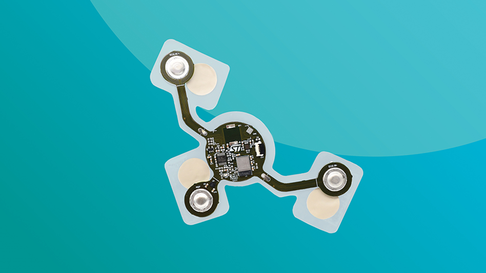 DuPont and ST integrated patch technology - Today's Medical Developments