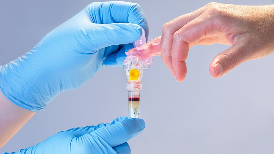 FDA 510(k) clearance for fingertip blood collection device - Today's ...