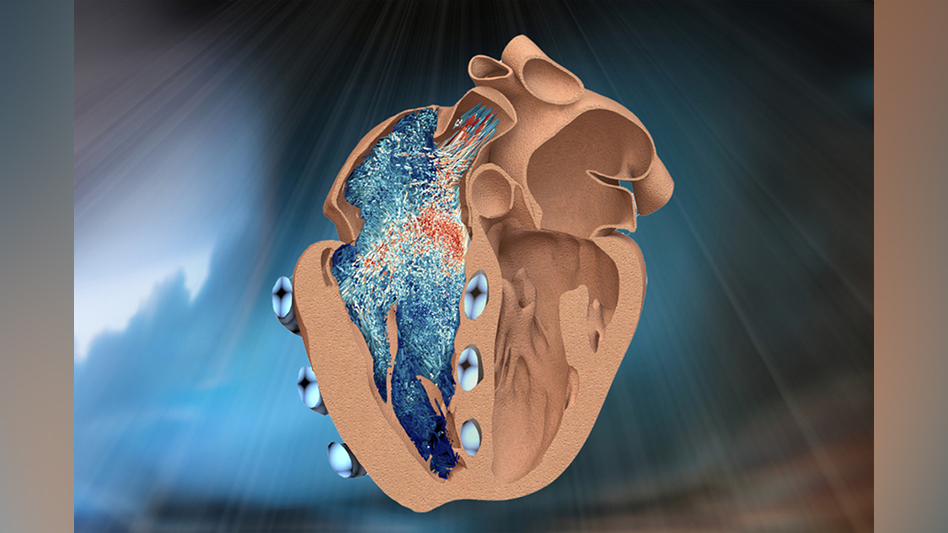 A robotic replica of the heart’s right chamber - Today's Medical ...