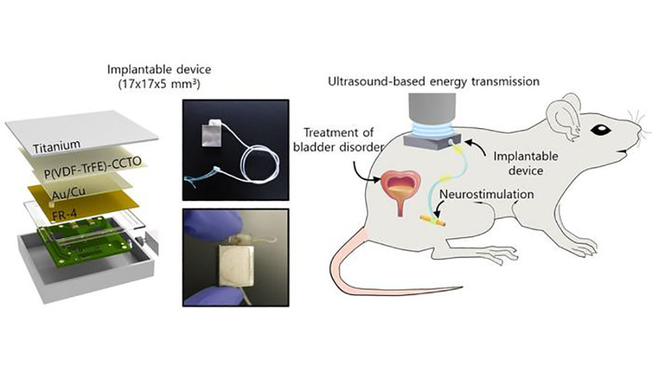 Static electricity enhances biomedical implant durability - Today's ...