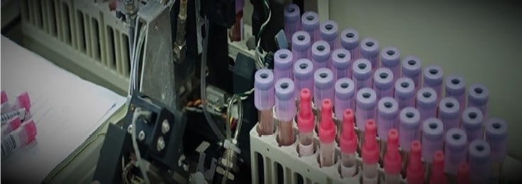 Leveraging automated testing - Today's Medical Developments