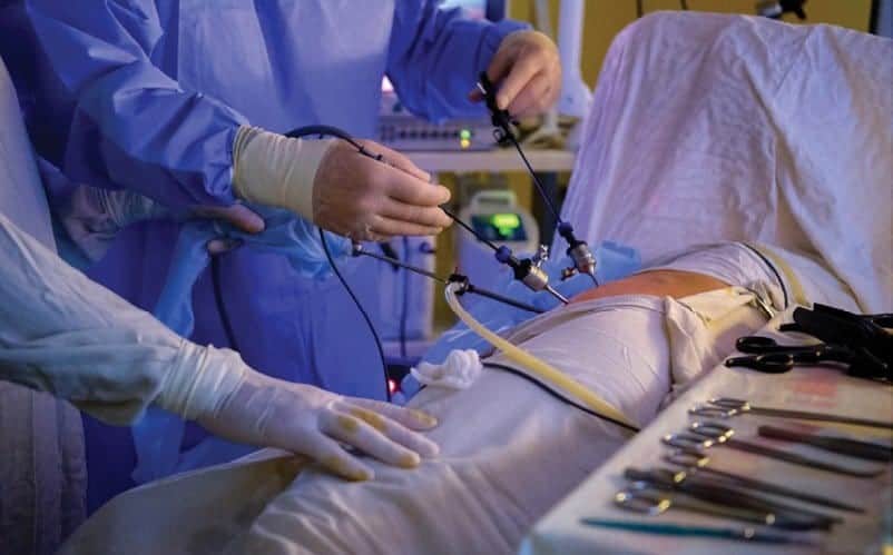 The advancement of minimally invasive device design - Today's Medical ...